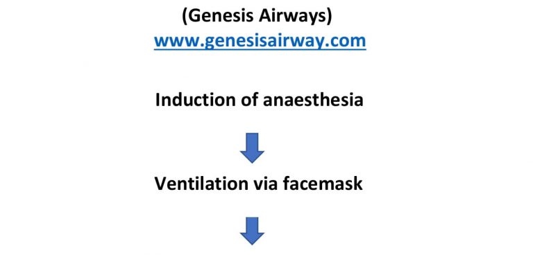 SECURE A NASAL AIRWAY SAFELY | Genesis Airway Innovations